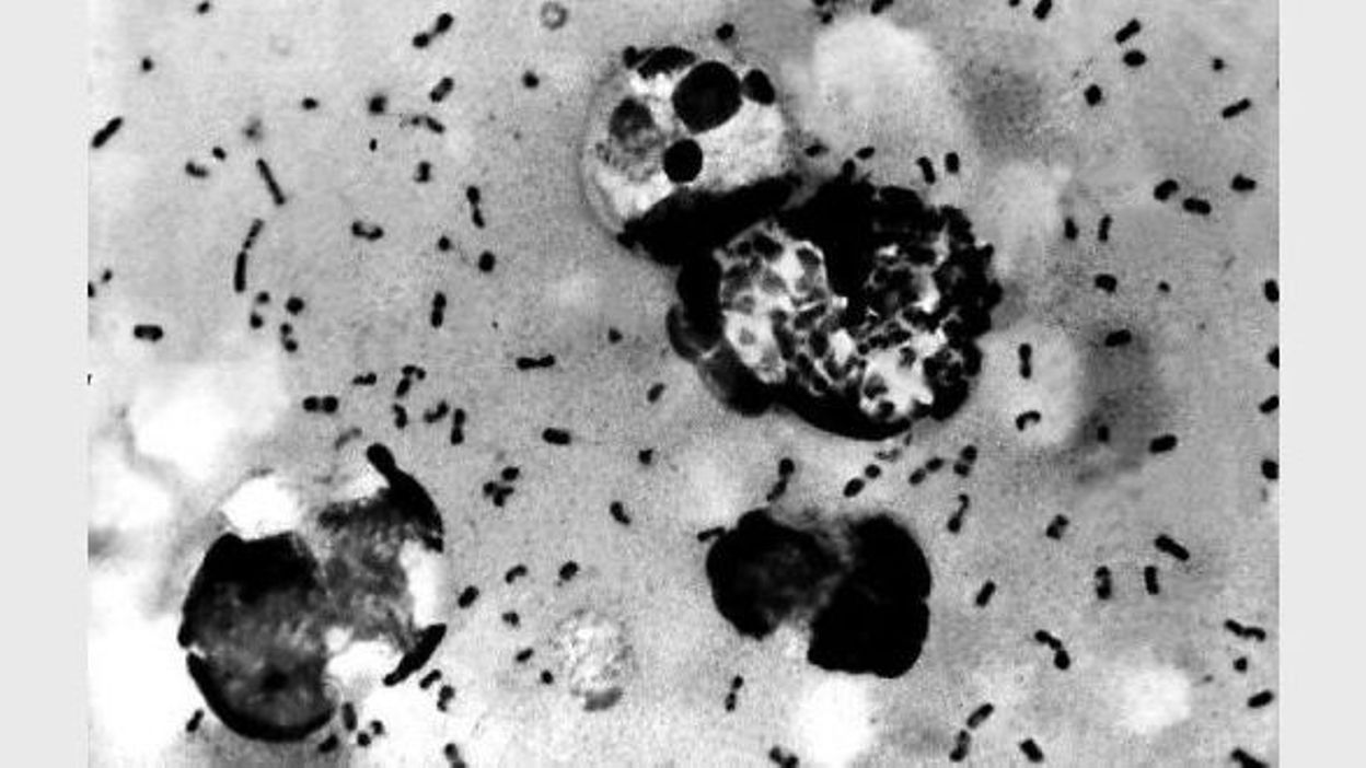 La peste noire de 1348 a véhiculé la bactérie pestis yersinia La peste noire de 1348 a véhiculé la bactérie pestis yersinia