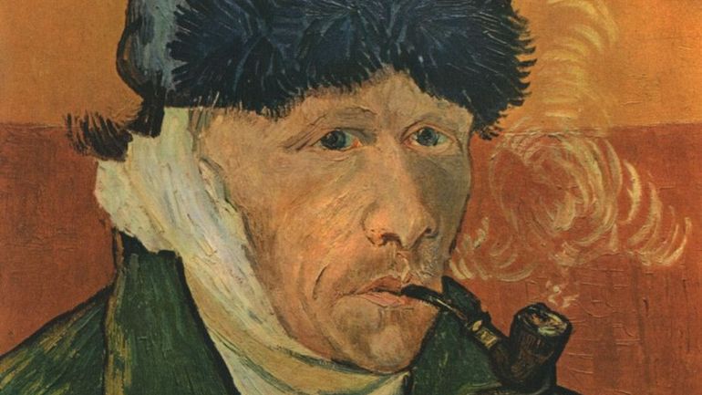 Des chercheurs américains percent le mystère de l'oreille mutilée de ...