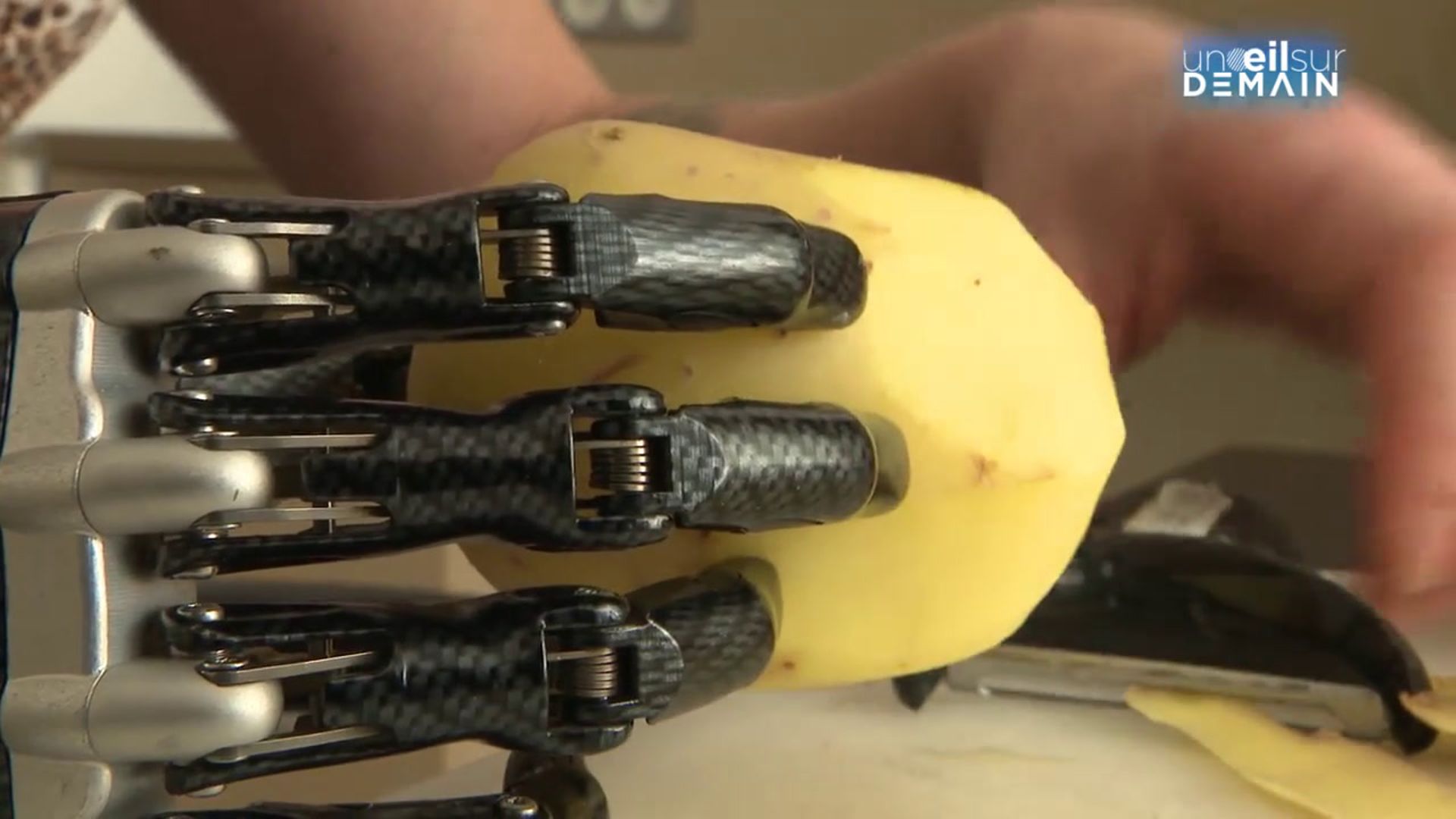 Un bras bionique contrôlé par la pensée, la prothèse de demain - rtbf.be