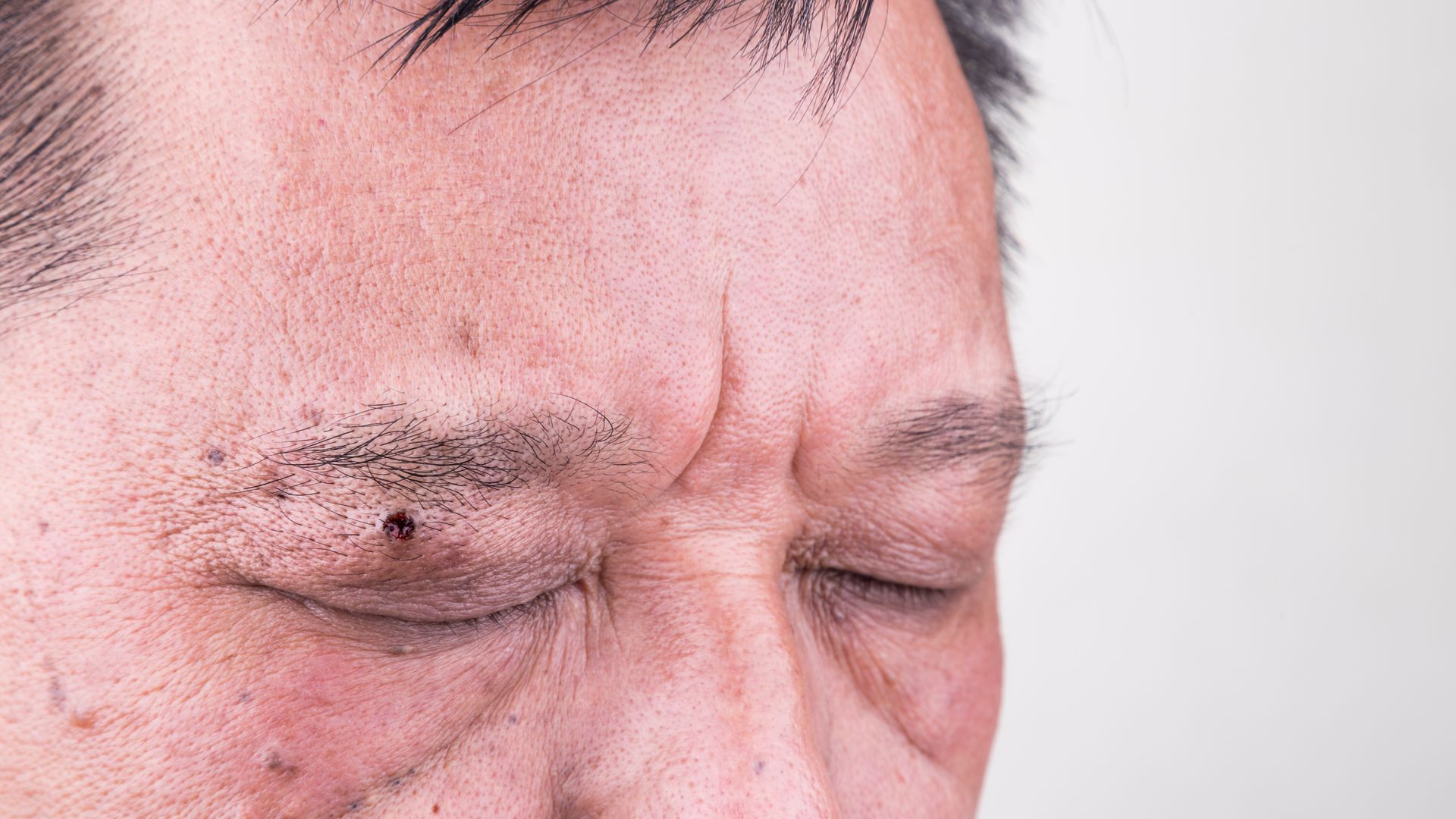 Quels sont les symptômes d'un cancer de l'œil ? - La Grande Forme - Auvio